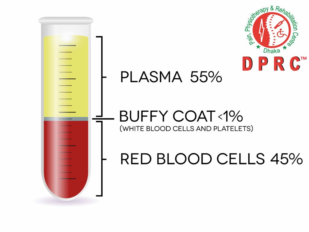Platelet-rich plasma or PRP